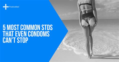 5 Most Common Stds That Even Condoms Cant Stop Positivemed