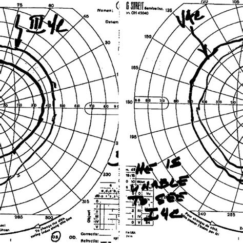 Visual Field Testing In Left And Right Eyes Download Scientific Diagram