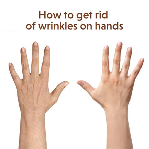 How To Remove Wrinkles From Hands Treatments And Home Remedies