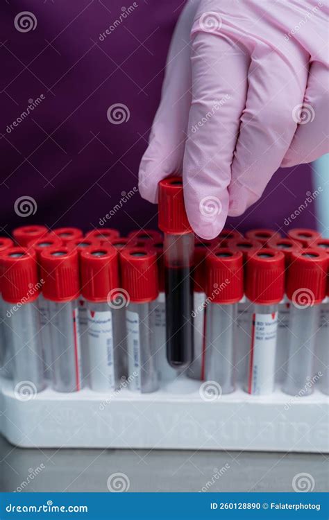 Tube Vials With Blood Sample Over A Rake With Medical Samples In The