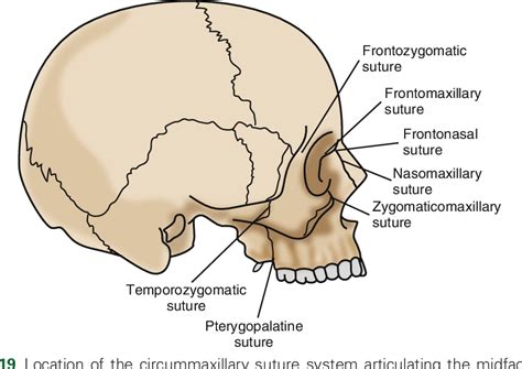 Nasomaxillary Suture