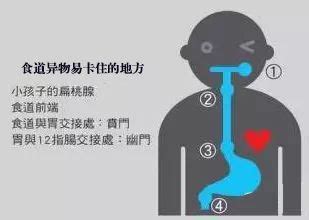 气管和食道的结构图 食道气管图 人的气管和食道图 大山谷图库