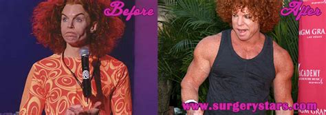 Steroids Before And After Carrot Top