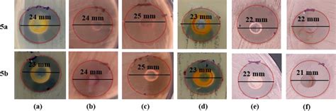 Diameter Of Inhibition Zones Of The Most Active Compounds 5a And 5b