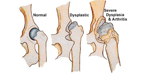 Hip Dysplasia In Dogs Causes Prevention And Treatment