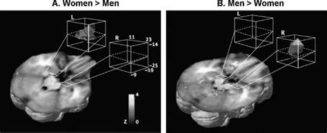 Sex Related Differences Identified In The Amygdala Showing A Download Scientific Diagram