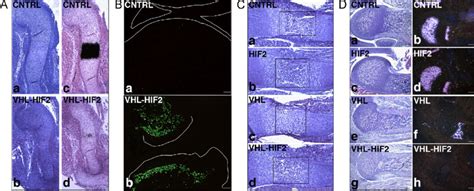 Growth Plate Phenotype Of Vhl Hif2 Mice A Delayed Terminal