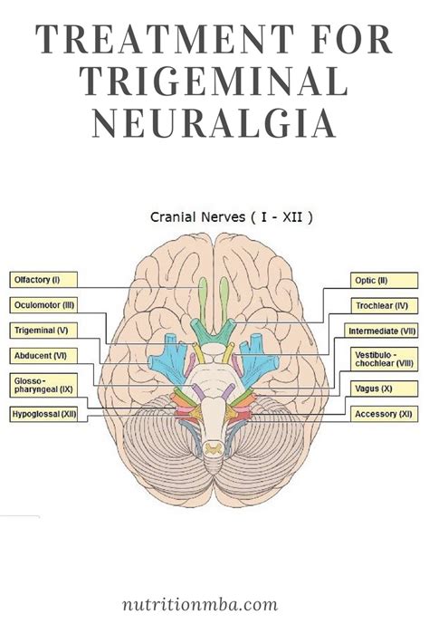 What Triggers Trigeminal Neuralgia Artofit