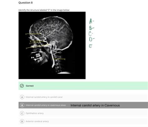 Solved Question 8 Identify The Structure Labeled C In The