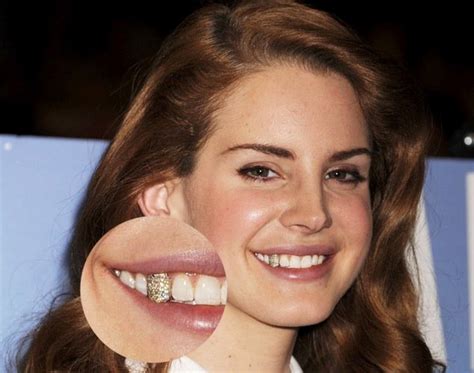 17 Best Images About Celebrity Teeth On Pinterest Dental Medical And