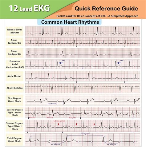Pin On Telemetry 50 Off Gbu