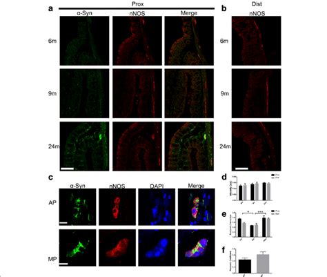 Expression Of NNOS In Enteric Neurons Of The Colon Of Transgenic Mice Download Scientific