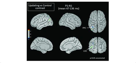 Statistical Map Cortex Only P