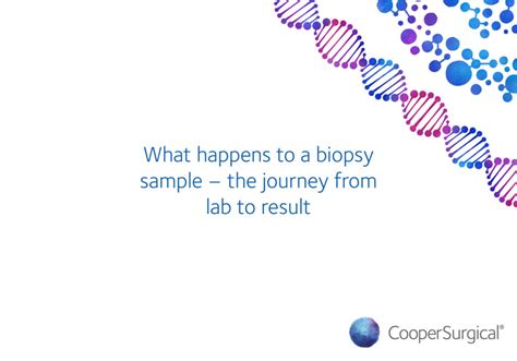 What Happens To A Biopsy Sample The Journey From Lab To Result CooperSurgical
