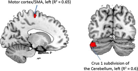 Relationship Between Sex Differences In Core Impairments And Brain Download Scientific Diagram