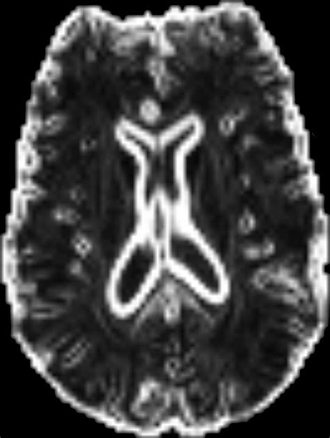 9 Norm Of The Gradient Of A Tensor Eld Same Slice As Fig 48 Download Scientific Diagram