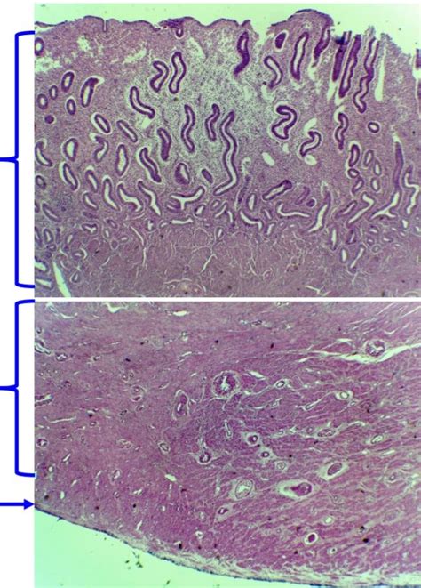 Uterus Diagram Quizlet