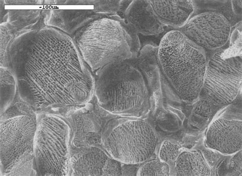 CRYO SEM MICROGRAPH AT HIGH MAGNIFICATION X 500 OF CELLS AT Download Scientific Diagram