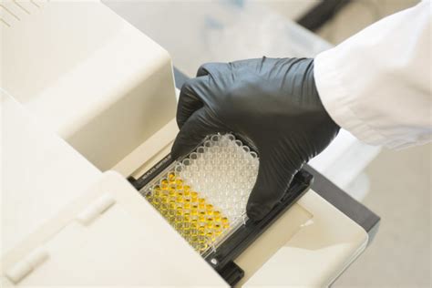 Biomarker Discovery And Analysis