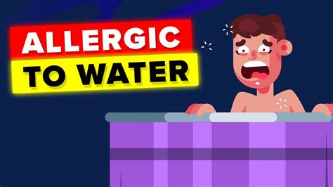 Woman Allergic To Water This Is How She Lives Youtube