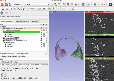 question on saving support 3d slicer community
