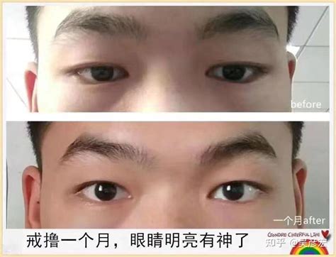 惊讶戒色一个月眼神明亮有神了图片对比 知乎