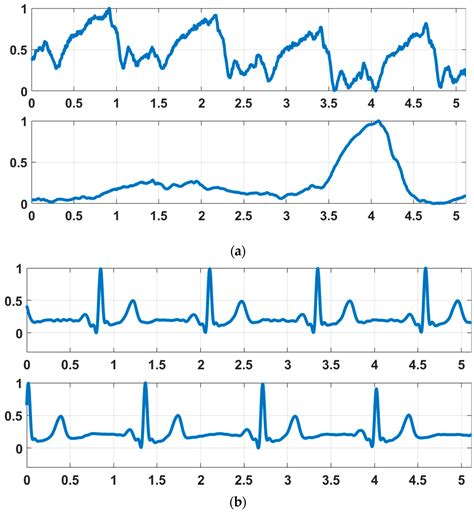 End To End Electrocardiogram Signal Transformation From Continuous Wave