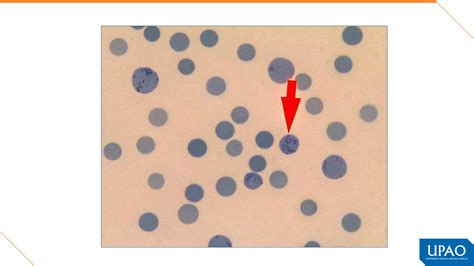 Presentacion Sobre Los Tipos De Diferentes Macrofagos Y Hemoglobina Pdf
