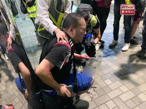 咬甩趙家賢耳朵男子申請刑期上訴許可獲批 Rthk