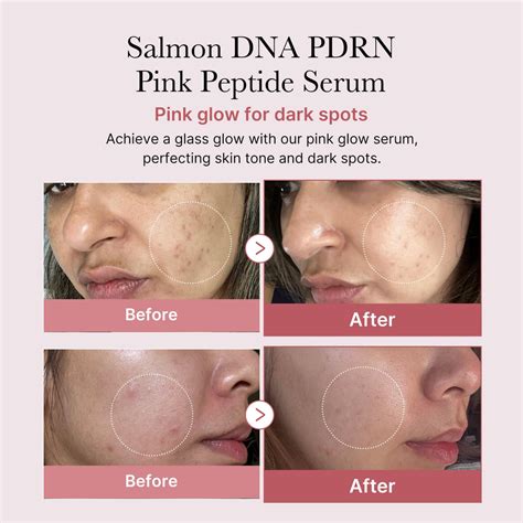 Medicube Salmon Dna Pdrn Duo For Beginner Salmon Dna Pdrn Pink Collag