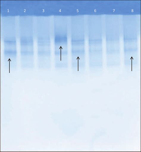 Native Gel 10Ð20 Of Soybean Leaf Protein Extract Stained For Download Scientific Diagram