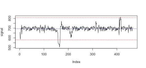 Time Series Conditional Peak And Valley Signal Detection In Realtime