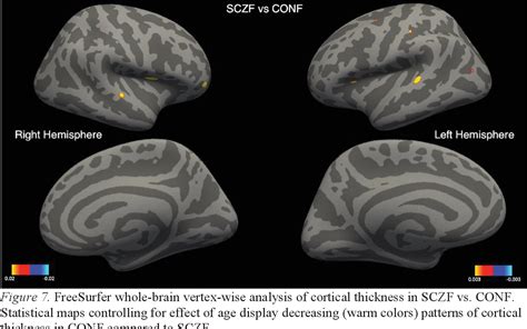 Figure 7 From The Influence Of Sex On Cognitive Control Performance And Frontoparietal Network