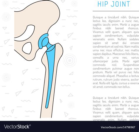 Medical Hip Joint Royalty Free Vector Image Vectorstock