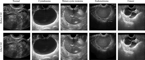 Ultrasound Images Before And After Removing The Marks Via The Download Scientific Diagram