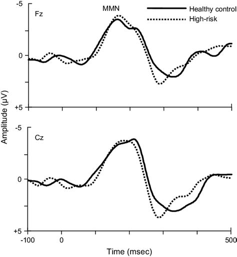 Group Mean Event Related Potential Erp Difference Waveforms Formed