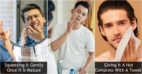 Super Easy Effortless Ways To Pop A Pimple With Any Scarring Or Damage To The Skin