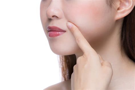 Skin Tone And Texture Dermatology And Laser Centre Of Los Angeles