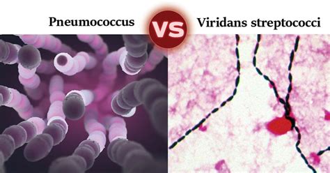 Differences Between Streptococcus Pneumoniae And Viridans Streptococci Overall Science