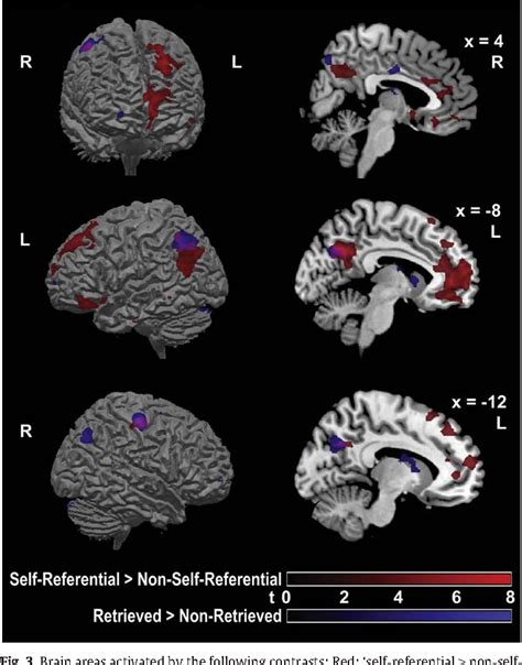 Figure 3 From Delineating Self Referential Processing From Episodic Memory Retrieval Common And