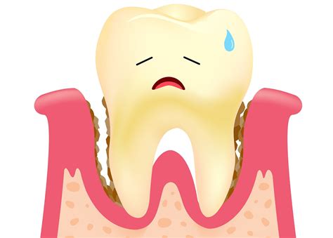 잇몸이 붓는 이유와 치료방법 알아볼까요