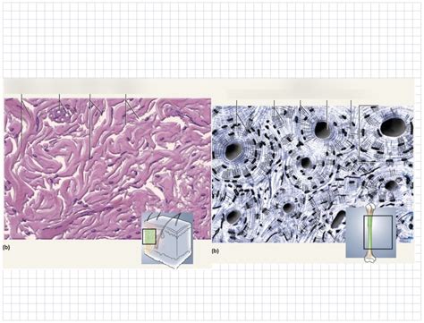 Lab D Dense Irregular Connective Tissue Compact Bone Diagram Quizlet