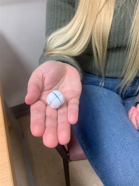 First Patients In Uk Receive Revolutionary Device To Stop Acid Reflux And Heartburn Western