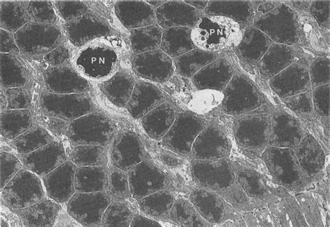 A Rat Retina 12 Hours After 2000 Rad The Outer Nuclear Layer Contains