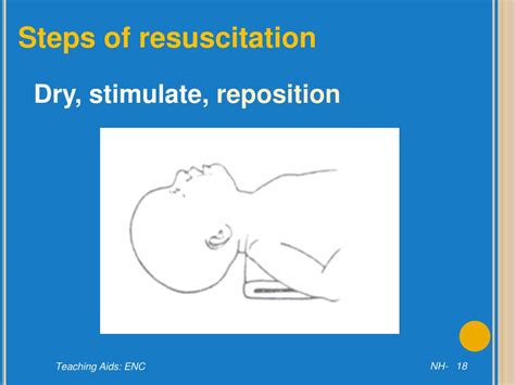 PPT Resuscitation Of The Newborn Baby PowerPoint Presentation ID 750443