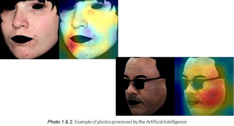 Facial Acne Recognition With Artificial Intelligence Joint Study CHOLLEY SUPSI Swiss