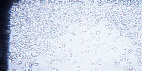 Cells Detection Object Detection Dataset And Pre Trained Model By Yasmine Zouggagh