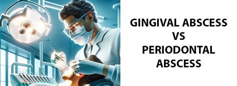 The Gingival Abscess Vs Periodontal Abscess Guide