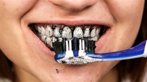 Is Brushing With Charcoal Good For Your Teeth Dental Image Therapy
