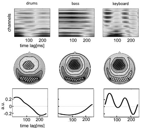 Spatio Temporal Regression Patterns And Extracted Music Components For